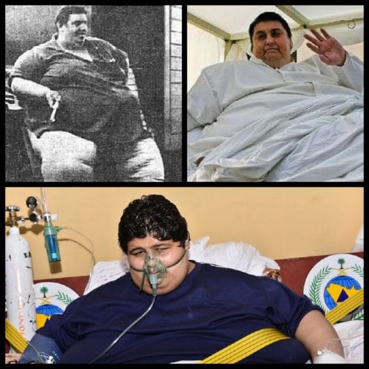 Top 5 Heaviest Person in the World